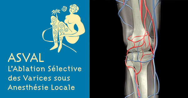 ASVAL - Paris Veine Institut